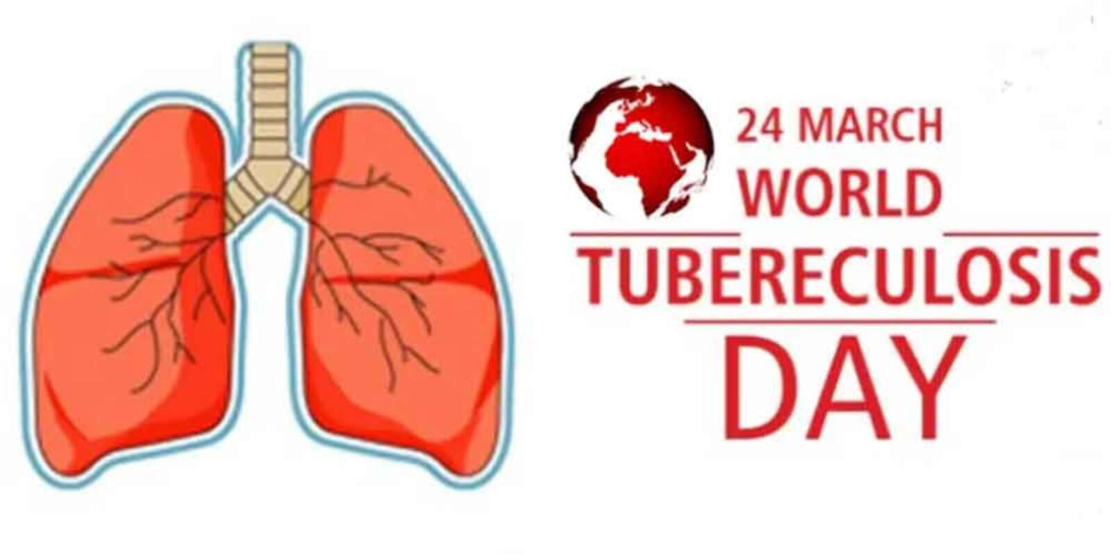 Svetski dan borbe protiv tuberkuloze – Radio KFOR Srpski